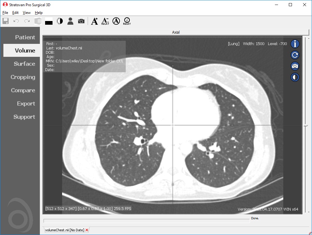 Pro Surgical 3D | Stratovan