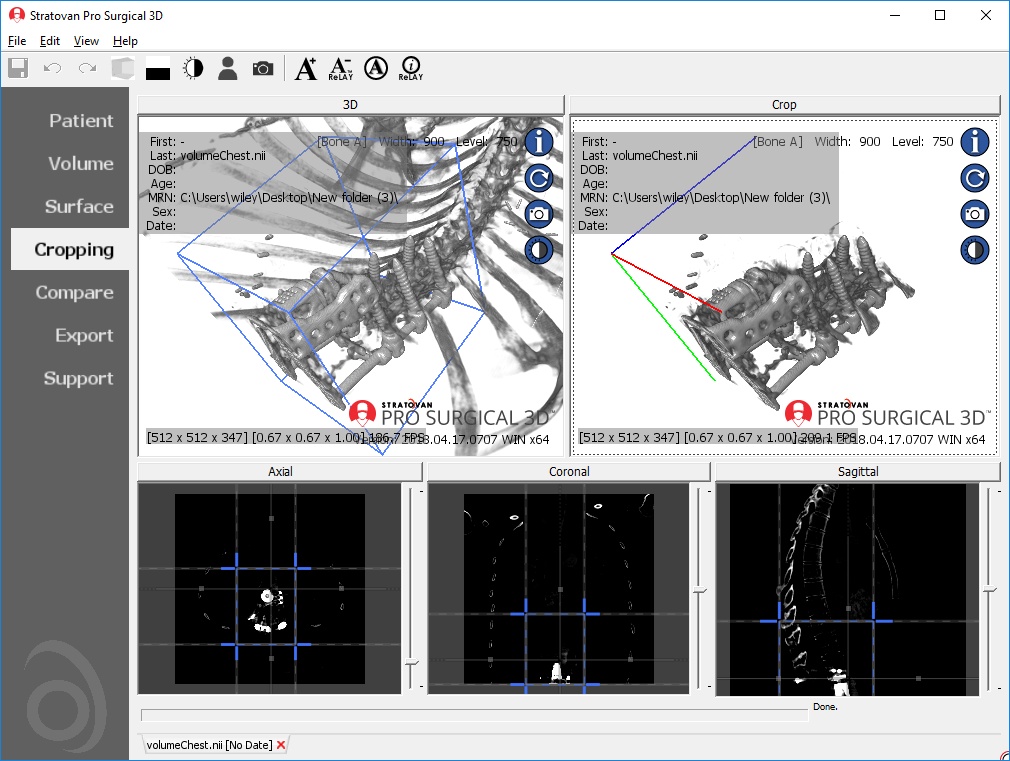 Pro Surgical 3D | Stratovan