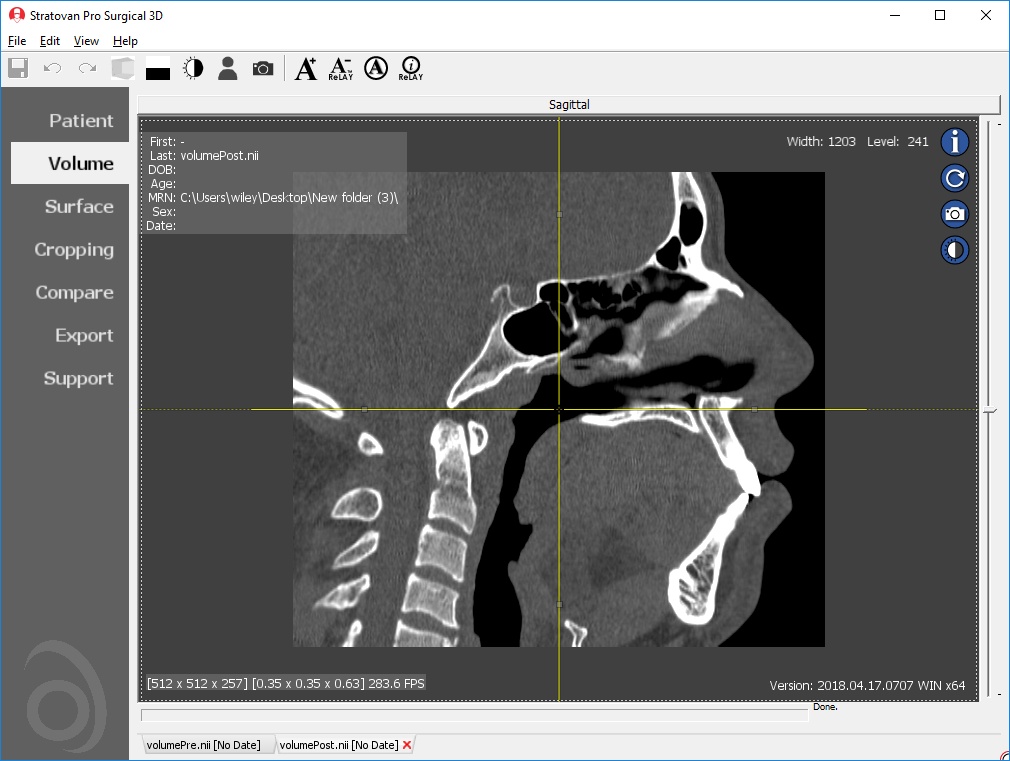 Pro Surgical 3D | Stratovan